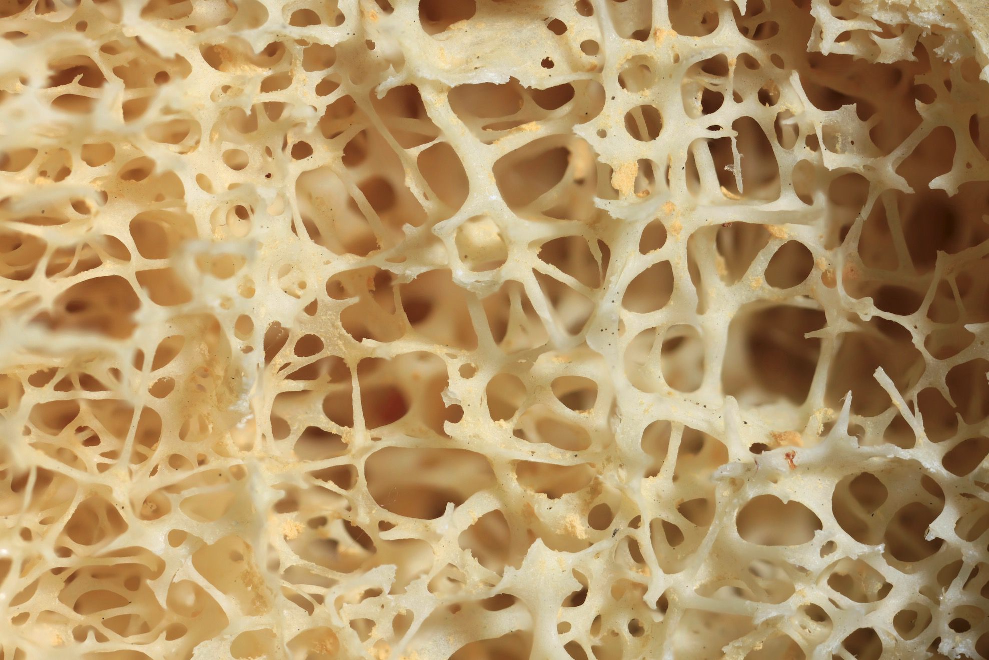 Knochenaufbau (Augmentation) mit köpereigenen Materialien im ...